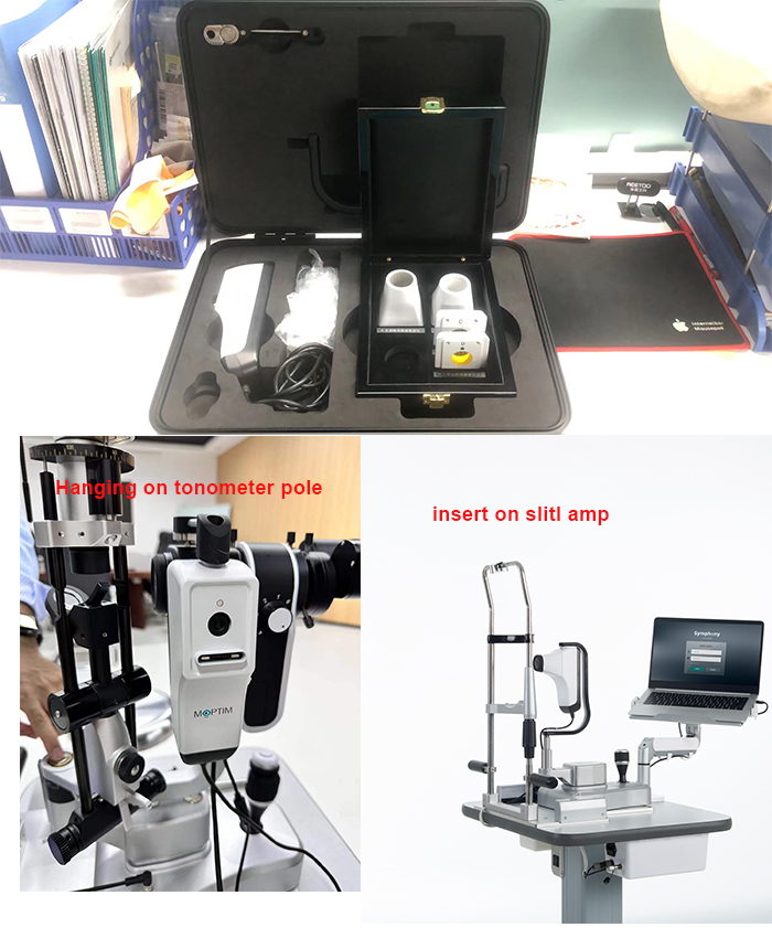 DEA China ophthalmic Dry Eye Examination surface Analyzer - Buy Dry eye ...