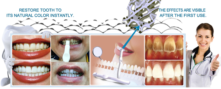 New teeth eraser for teeth cleaning at once- wholesale Teeth Eraser ...